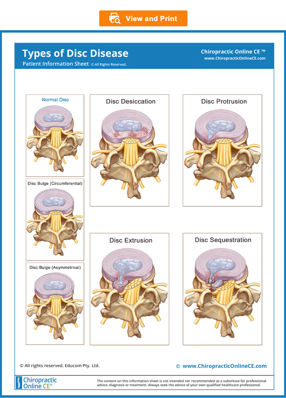Evaluating A Patient With Severe Low Back And Bilateral Leg Pain A