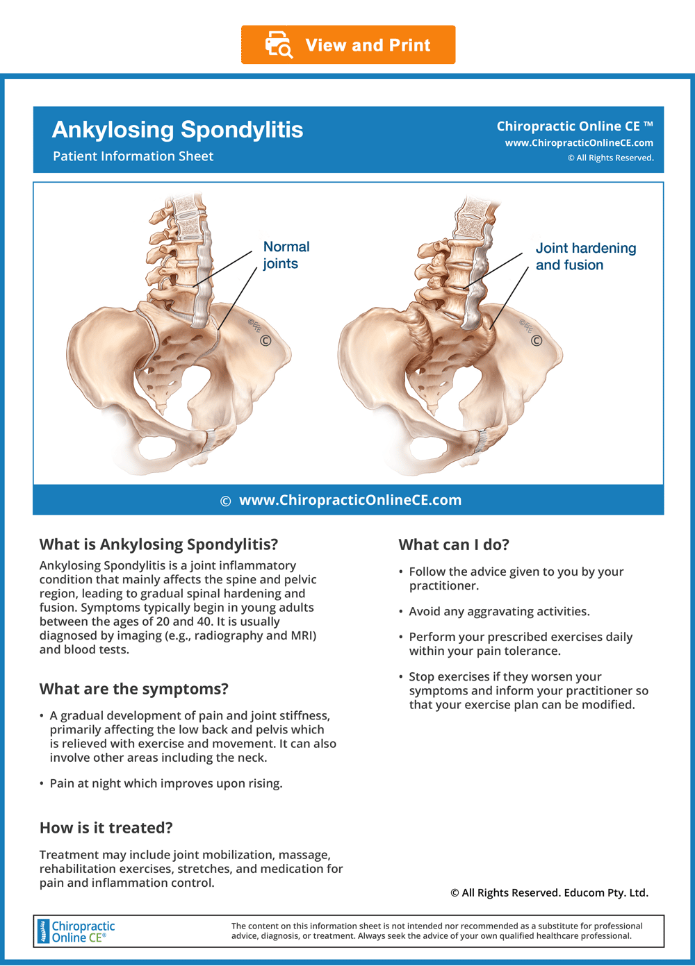 Ankylosing Spondylitis Heating Pad at Debra Millender blog