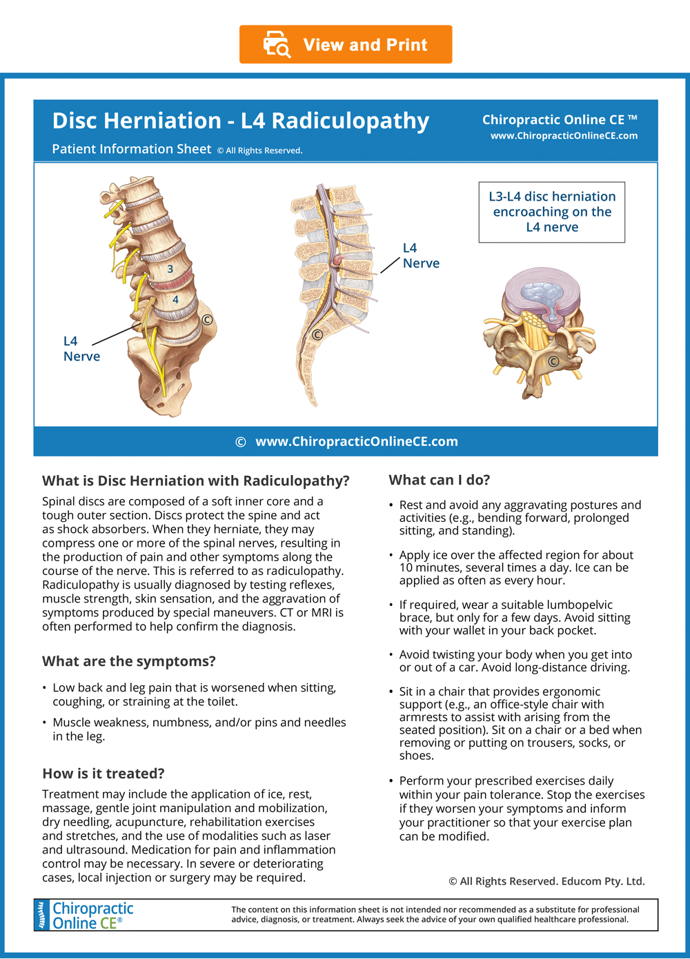 Lumbar Disc Herniation With Radiculopathy Symptoms at Shirley Funk blog
